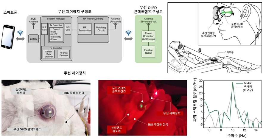 KAIST, 세계 최초 '착용형 OLED 콘택트렌즈'로 망막 검사 기술 구현